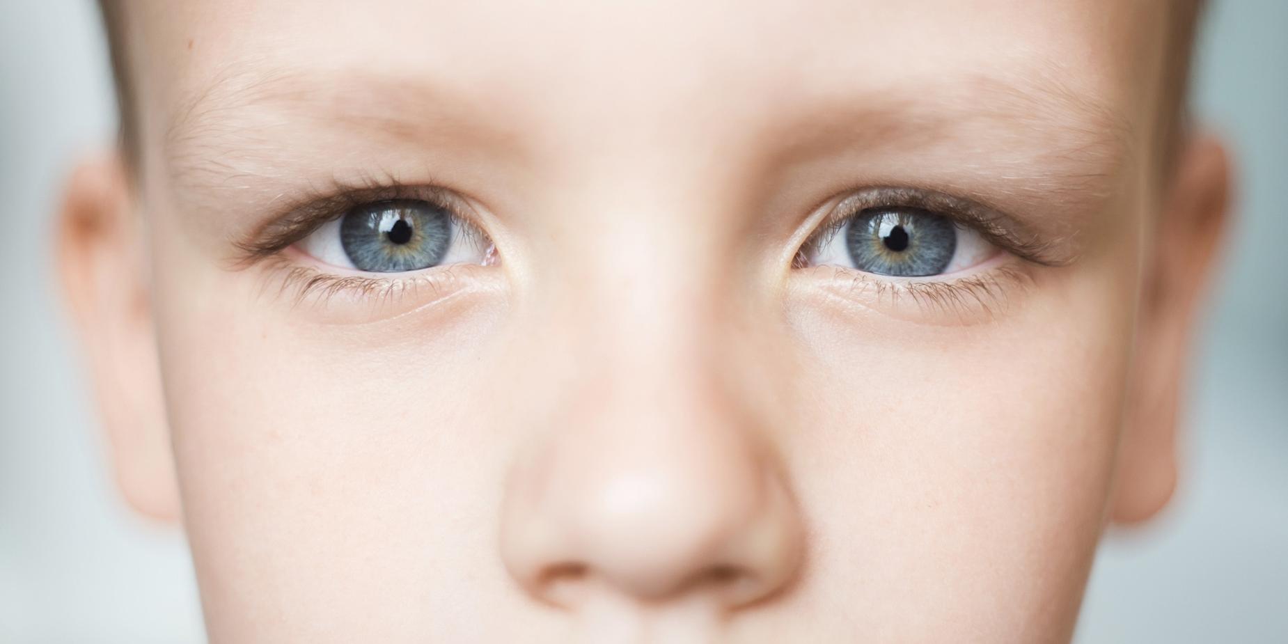 Blefarite all'occhio: cos’è, cause, sintomi e rimedi